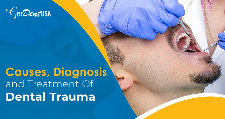 Causes, Diagnosis, and Treatment of Dental Trauma | GerDentUSA