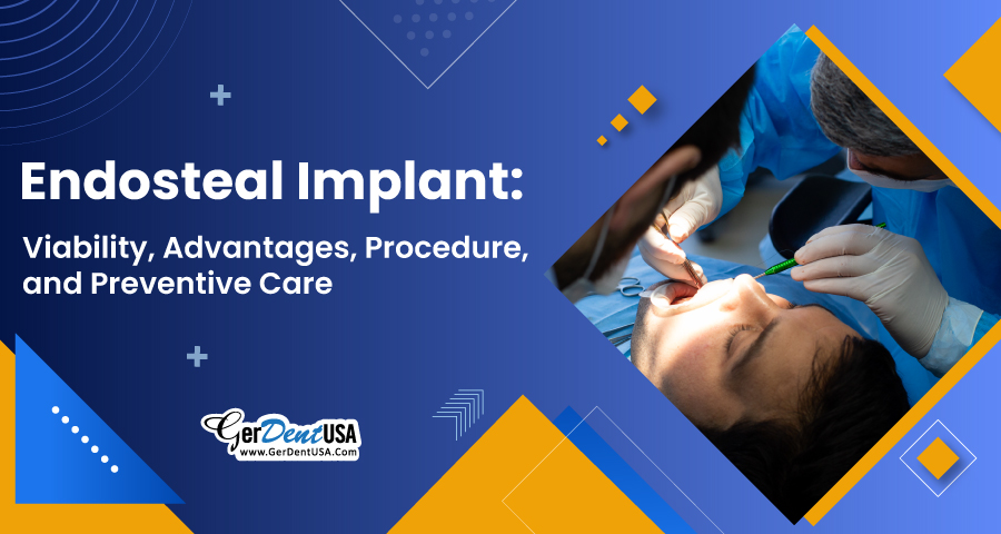 Endosteal Implant: Viability, Advantages, Procedure, and Preventive Care